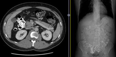 Computertomografie, CT, Schnittbilder des Körpers, Röntgenuntersuchung ...