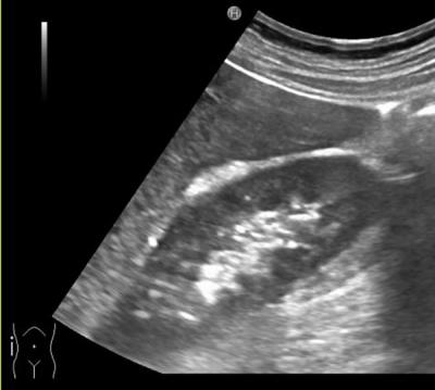 Ultraschall | diagnostikzentrum Gießen